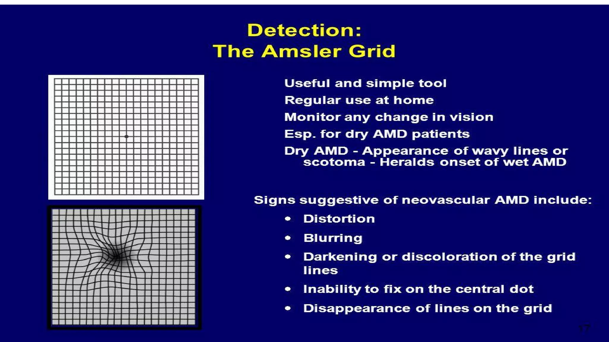 Amsler Grid Test | PDF