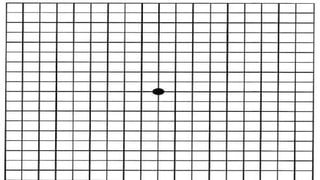 Amsler Grid Test | PDF