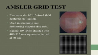 Amsler Grid Test | PDF
