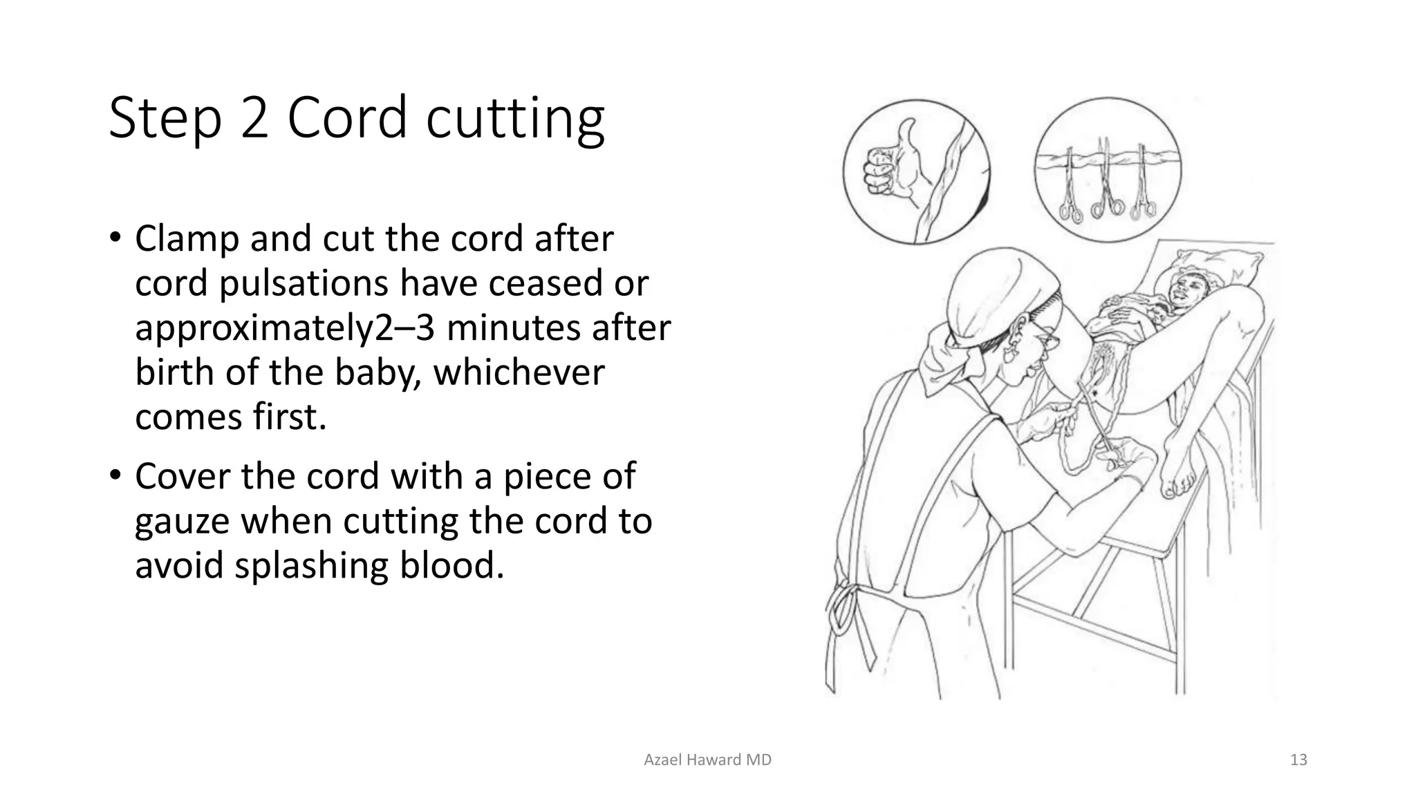 Active Management of Third Stage of Labor | PPTX
