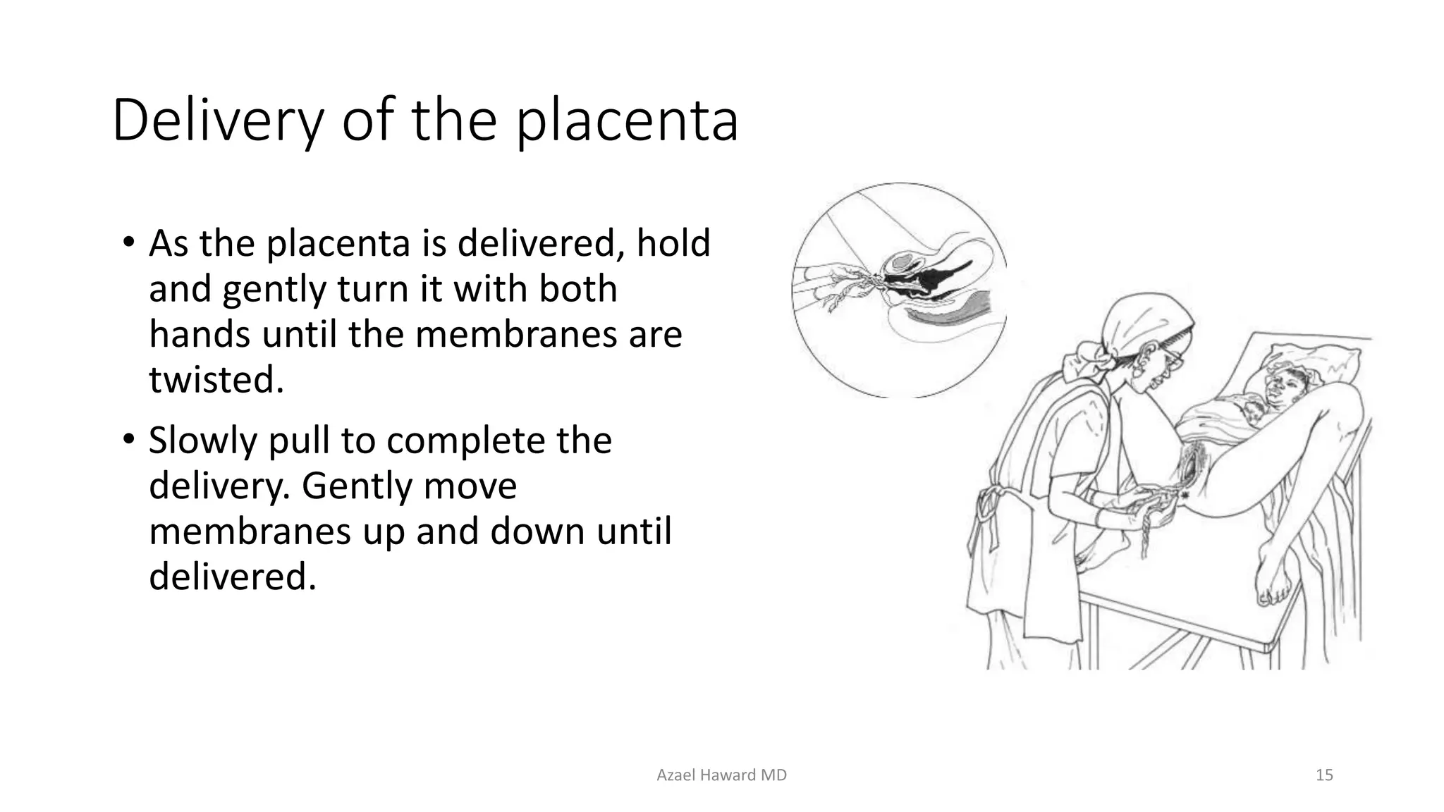 Active Management of Third Stage of Labor | PPTX