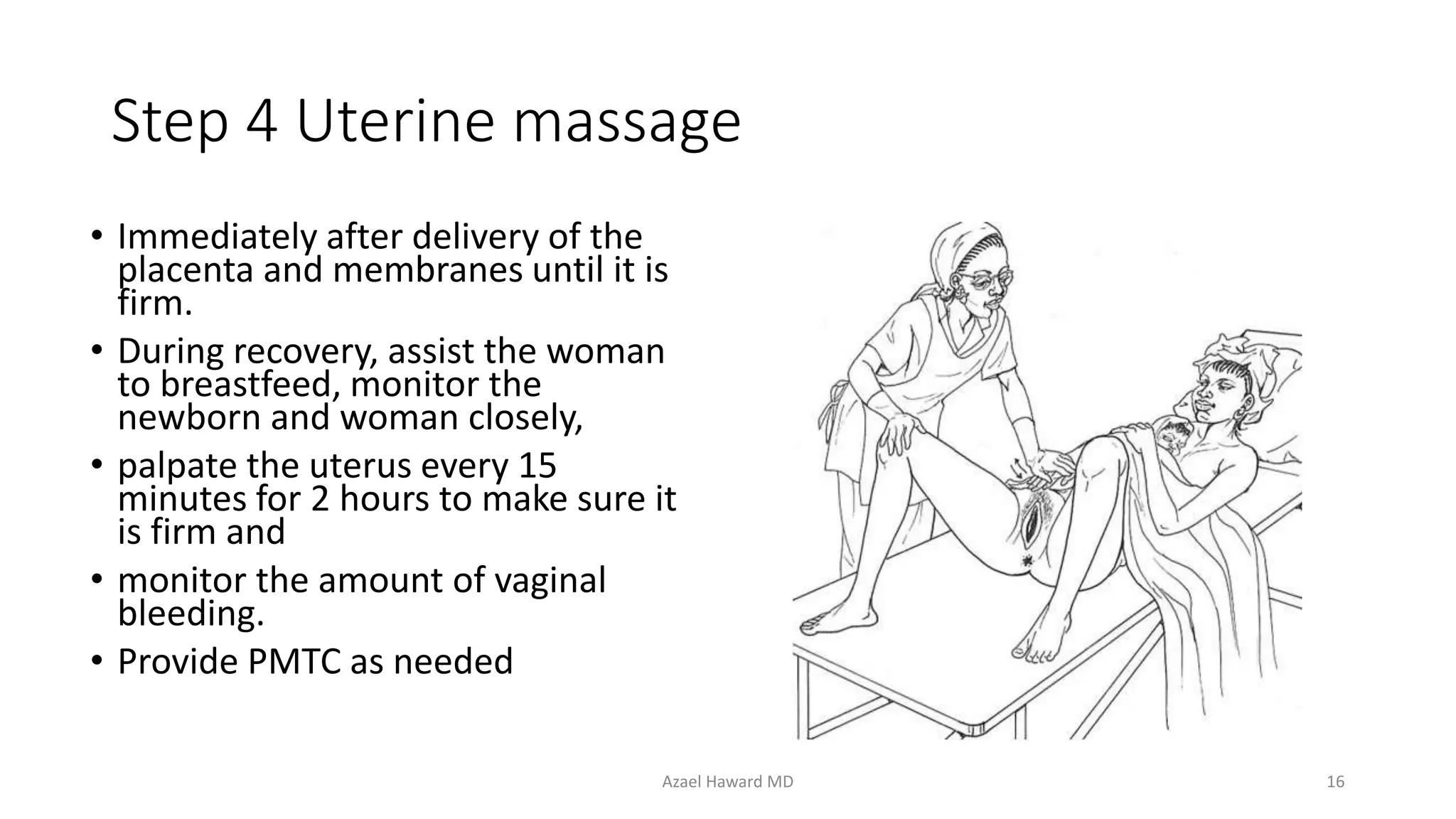 Active Management of Third Stage of Labor | PPTX