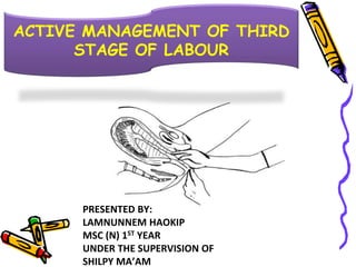 Active Management of Third Stage of Labour | PPTX