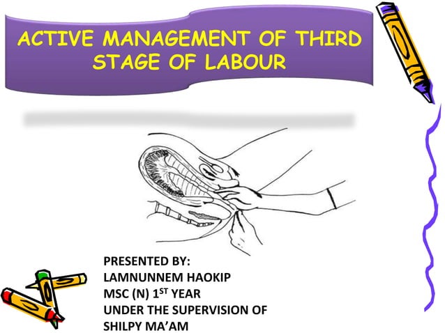 Active Management of Third Stage of Labour | PPTX