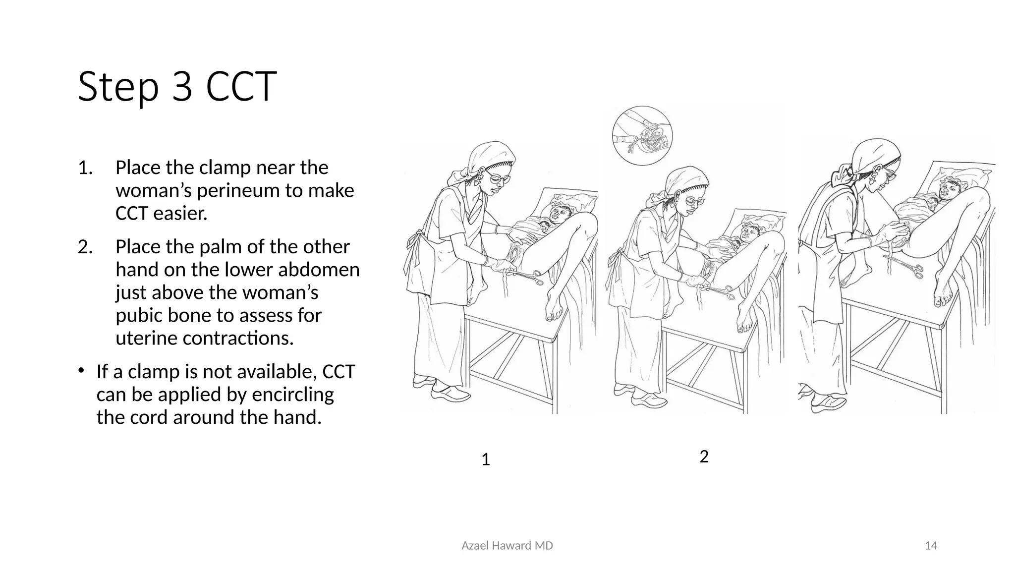 AMTSL,its a part of normal vaginal delivery. | PPTX
