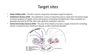 Deep brain stimulation | PPTX
