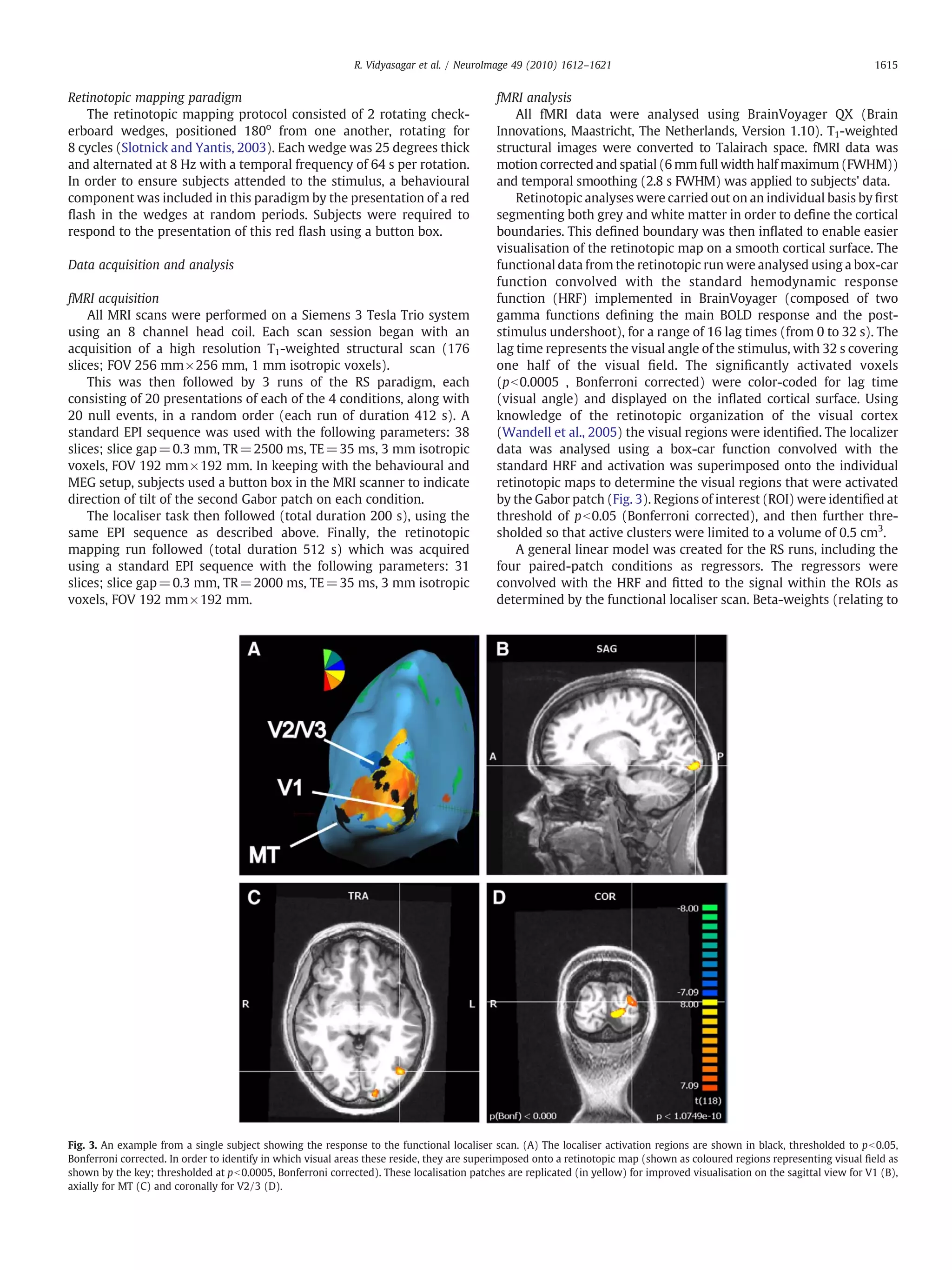 A multimodal brain imaging study of repetition suppression in the | PDF