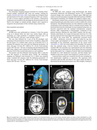 A multimodal brain imaging study of repetition suppression in the | PDF