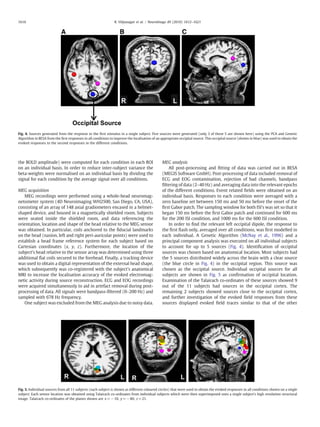 A multimodal brain imaging study of repetition suppression in the | PDF