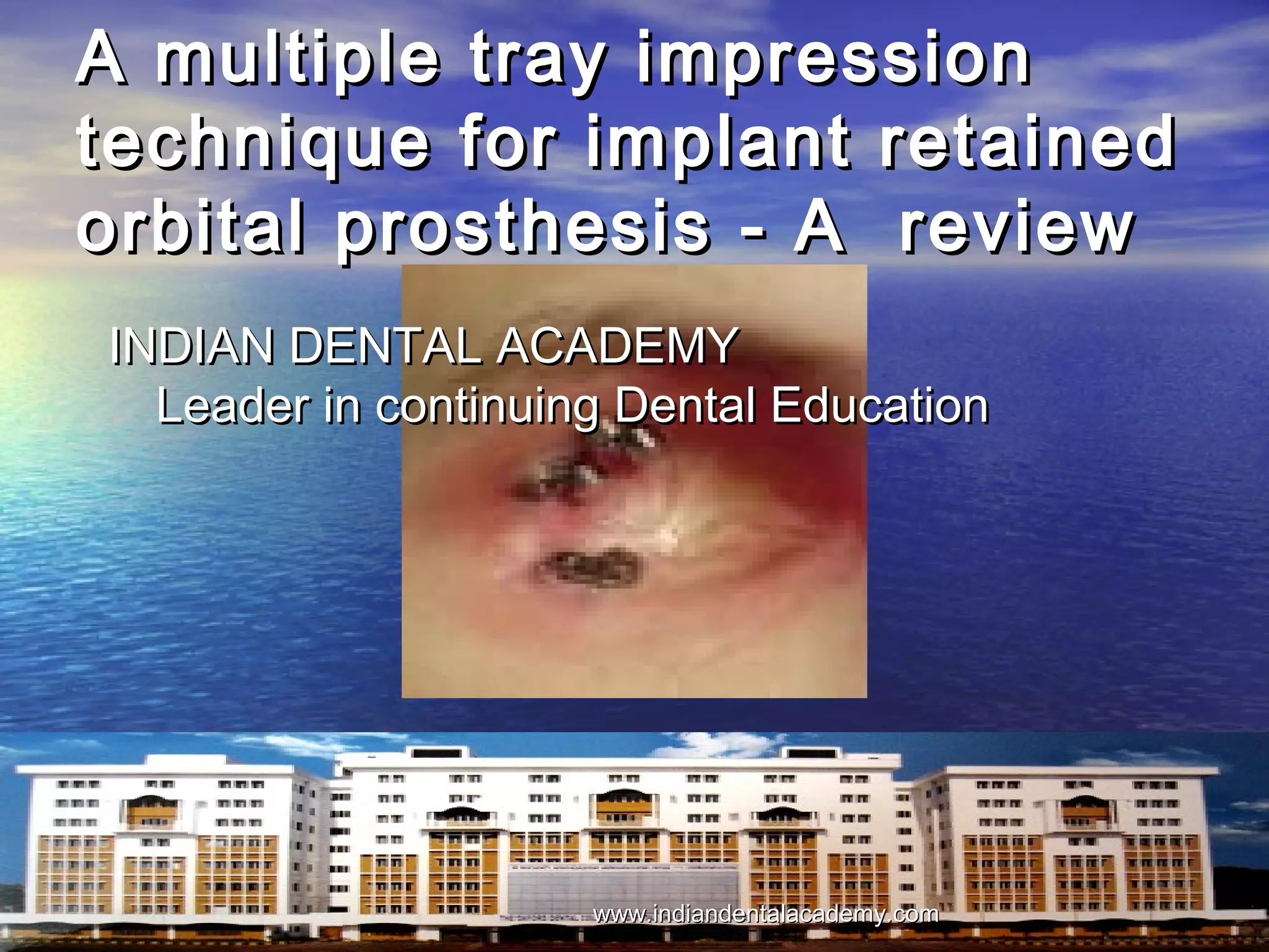 A multiple tray impression technique for implant retained orbital pro ...