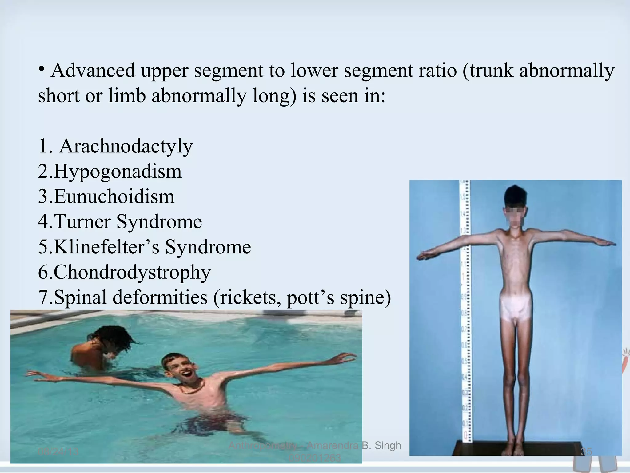 Anthropometry | PPT