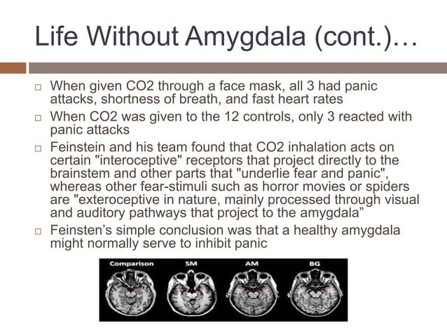 Amygdala Presentation | PPTX