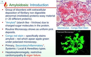 Amyloidosis | PPTX