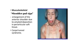 amyloidosis 2.pdf
