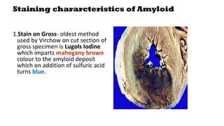 amyloidosis 2.pdf