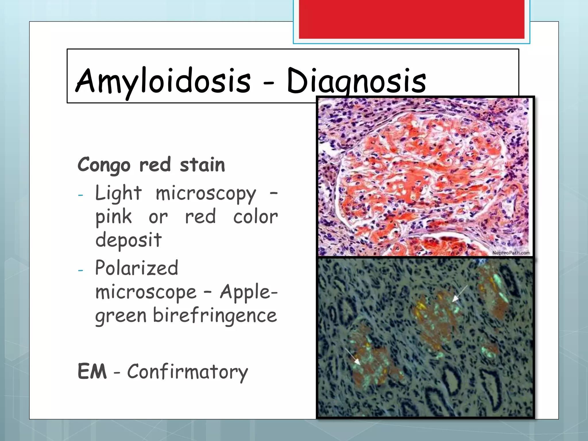 AMYLOIDOSIS | PPTX