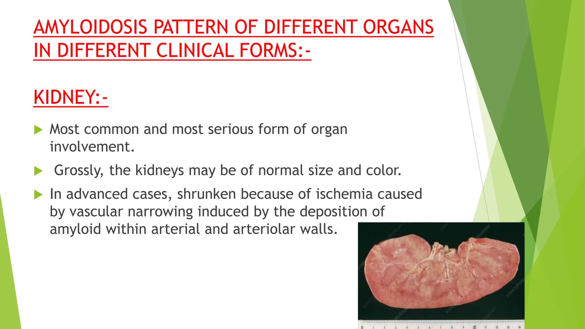 AMYLOIDDFHGDDSCBJUUFFFVVXFTGGVVBOSIS.pdf