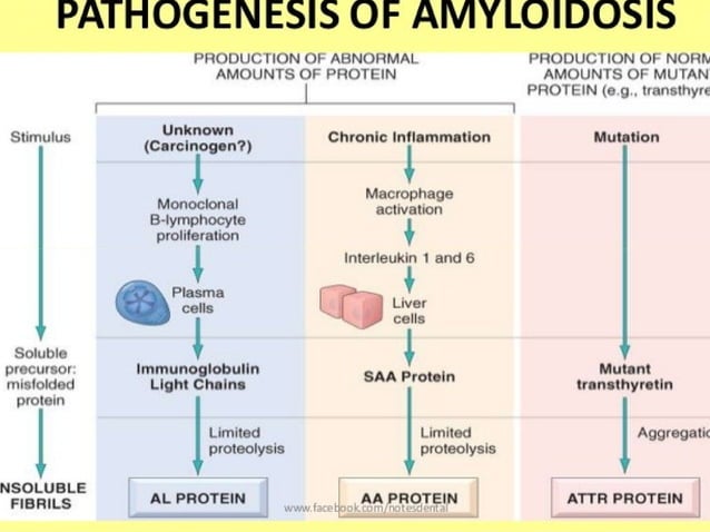 Amyloidosis ppt | PPT | Blood Disorders | Diseases and Conditions