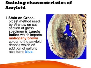 Amyloidosis ppt | PPT