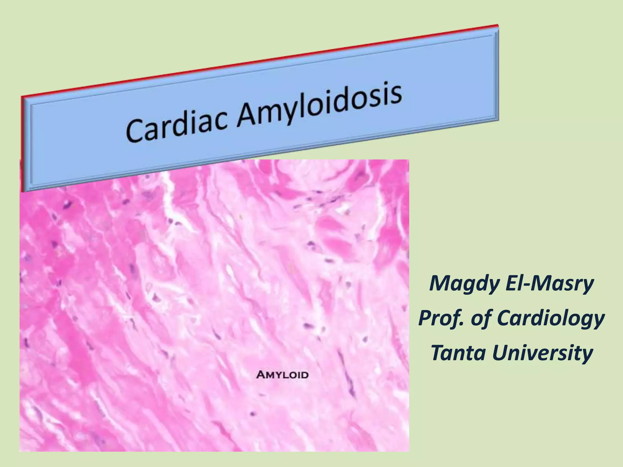 Cardiac Amyloidosis | PPTX