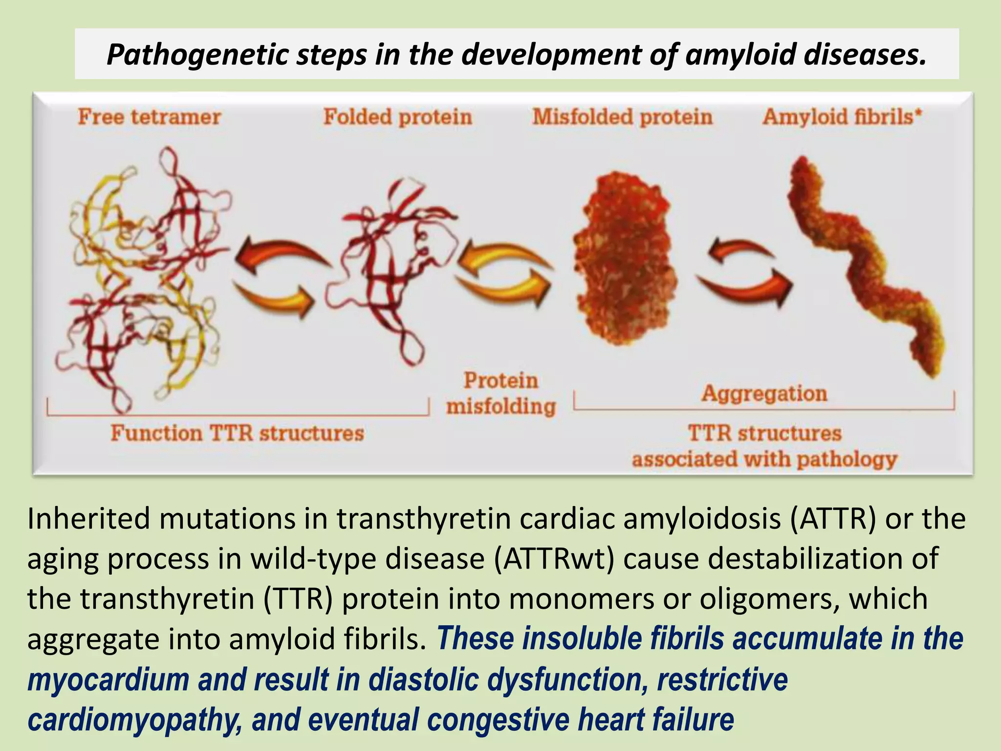 Cardiac Amyloidosis | PPTX