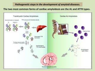 Cardiac Amyloidosis | PPTX