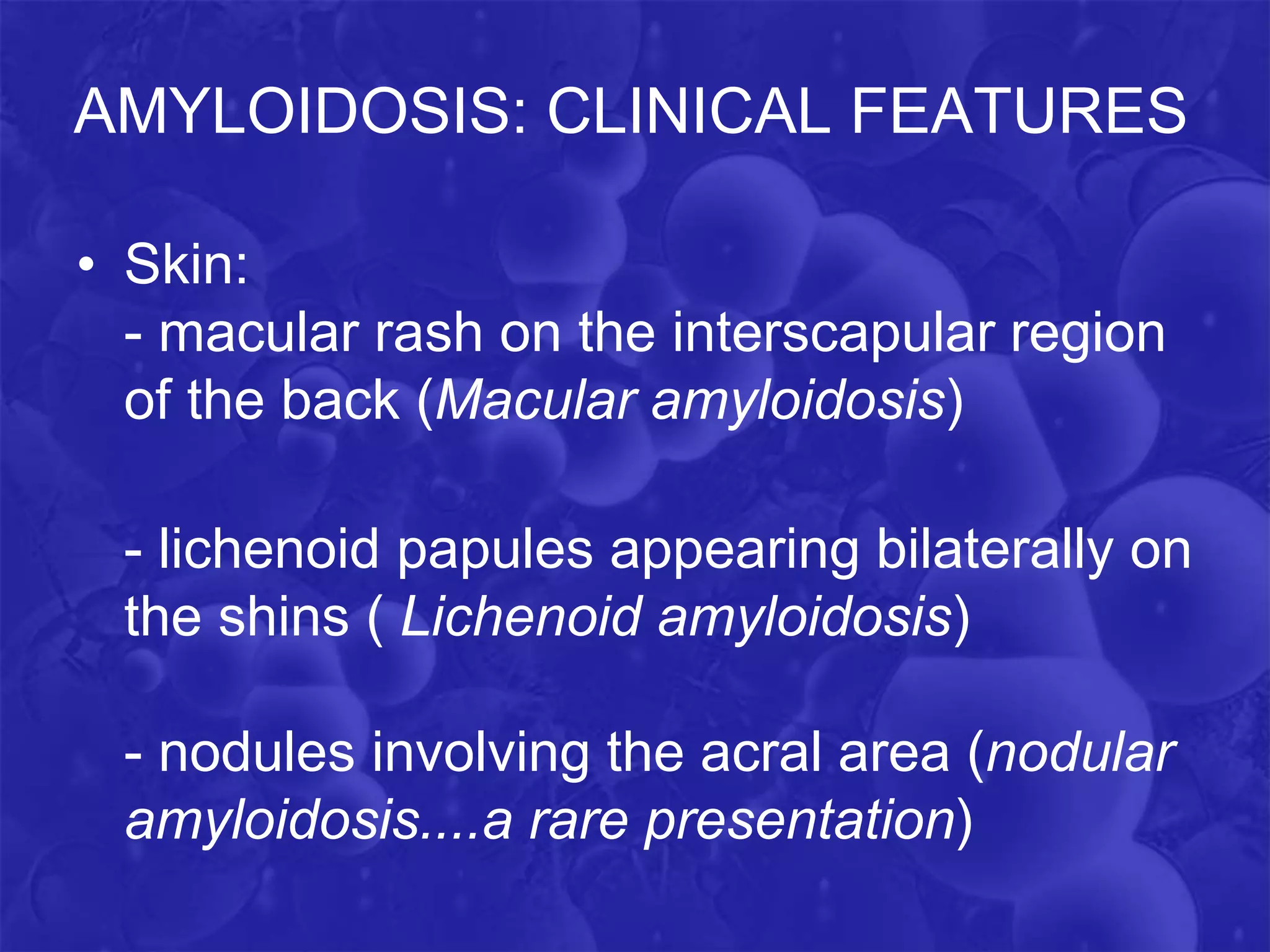 Amyloidosis | PPTX