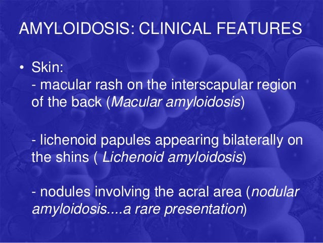 Amyloidosis