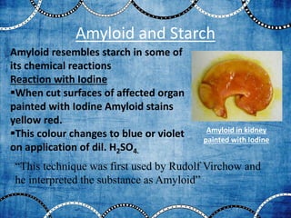 Amyloidosis presentation | PPTX