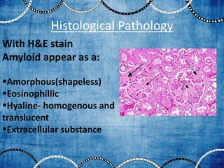 Amyloidosis presentation | PPTX