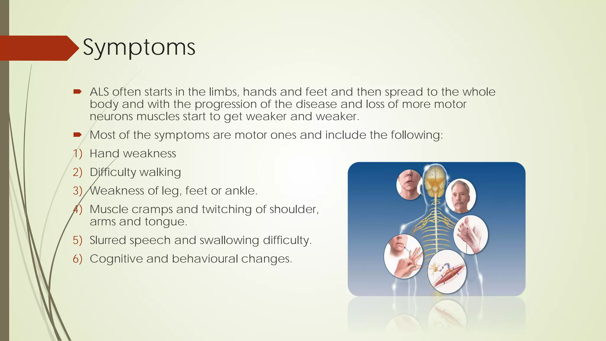 Amyotrophic lateral-sclerosis-als- | PPT