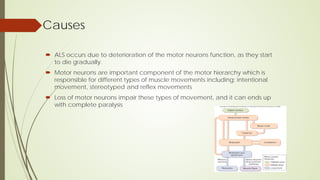 Amyotrophic lateral-sclerosis-als- | PPT
