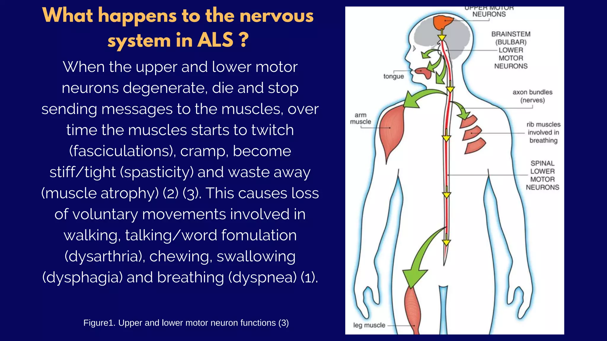 Amyotrophic Lateral Sclerosis based on "The Theory of Everything" | PPTX