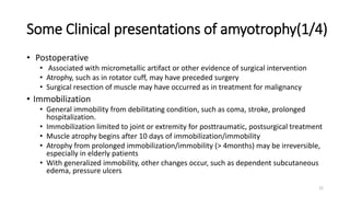 Muscle Atrophy (Amyotrophic) diseases by TSAMO.pptx