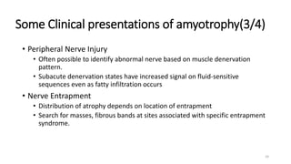 Muscle Atrophy (Amyotrophic) diseases by TSAMO.pptx