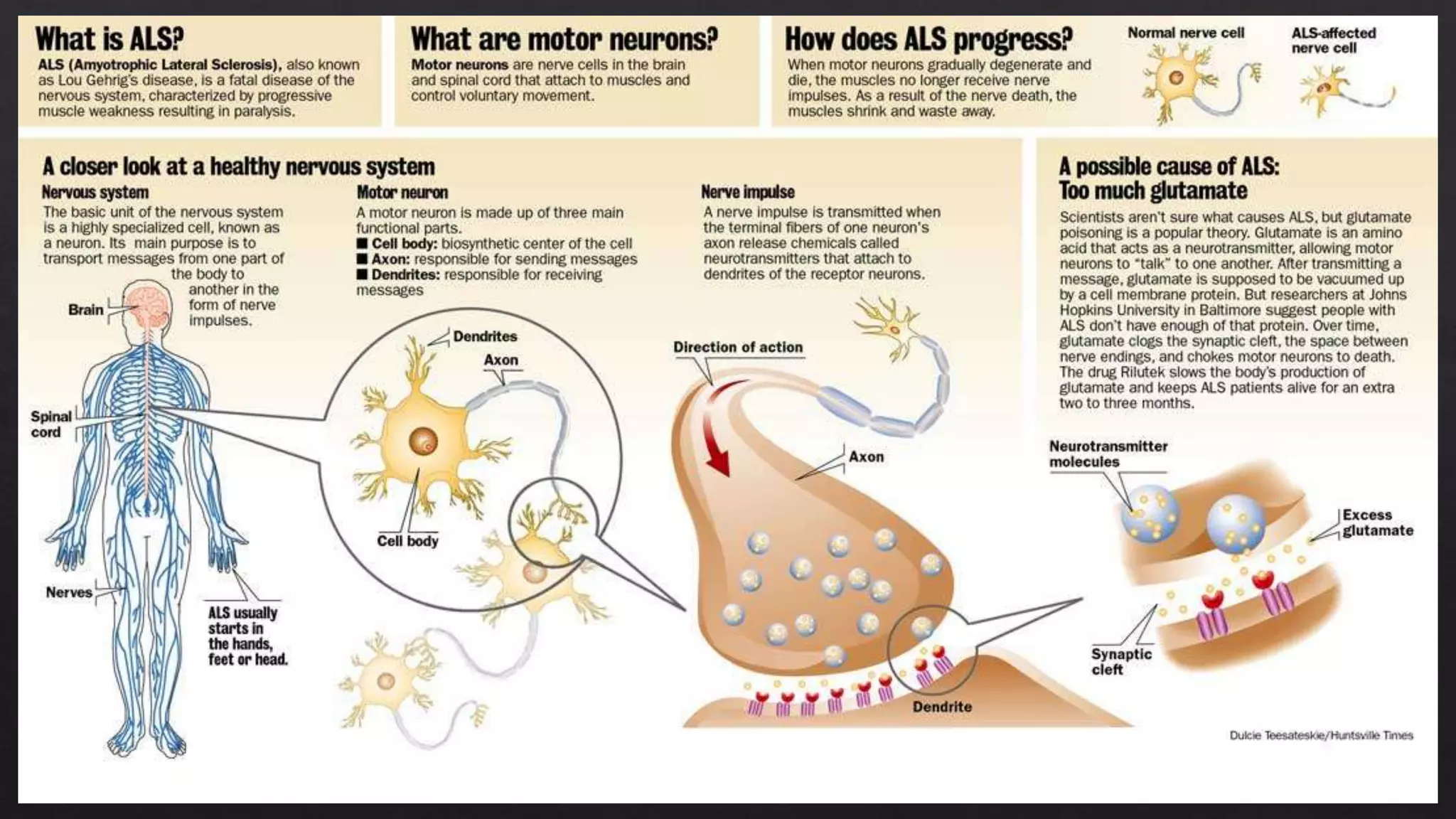 Amyotrophic Lateral Sclerosis (ALS) | PPT