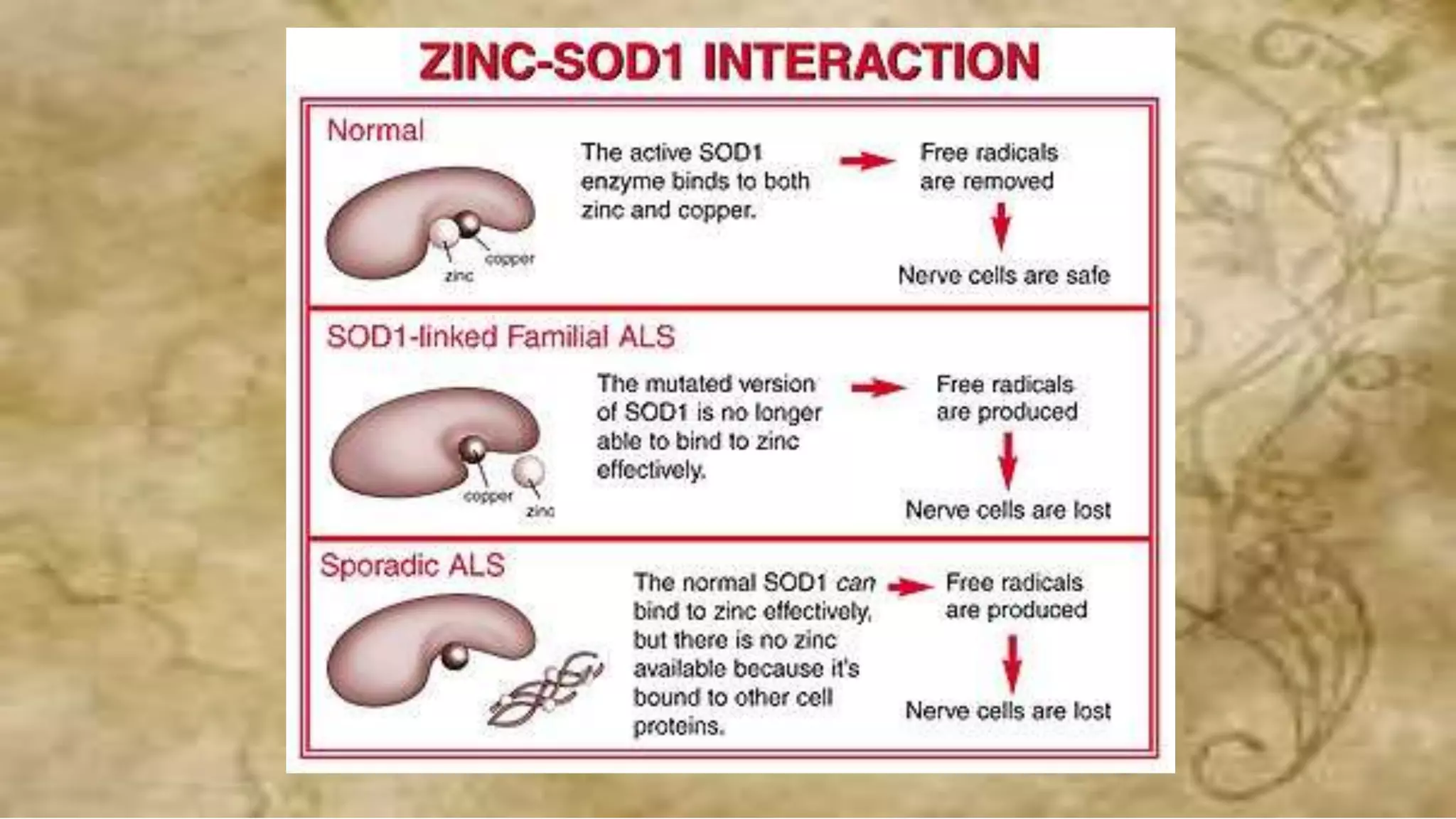 Amyotrophic lateral sclerosis (als) | PPTX