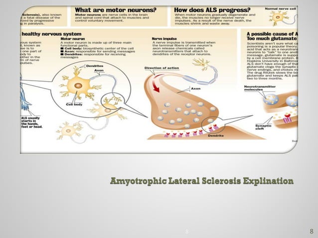 Amyotrophic Lateral Sclerosis | PPT