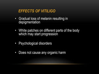 Vitiligo: A Chronic Skin Disorder | PPT