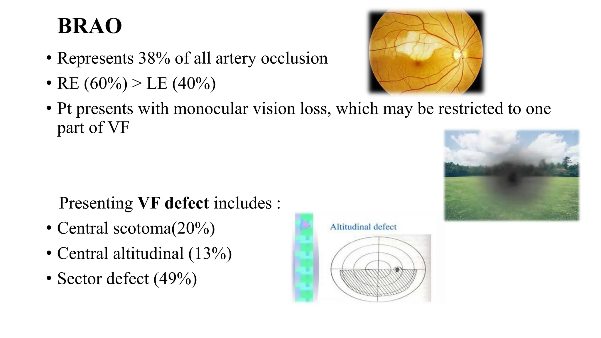 RETINAL ARTERY OCCLUSIONS CRAO BRAO CLRAO | PPTX