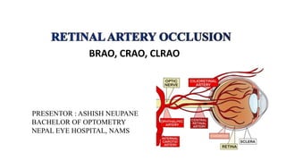 RETINAL ARTERY OCCLUSIONS CRAO BRAO CLRAO | PPTX