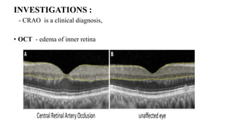 RETINAL ARTERY OCCLUSIONS CRAO BRAO CLRAO | PPTX