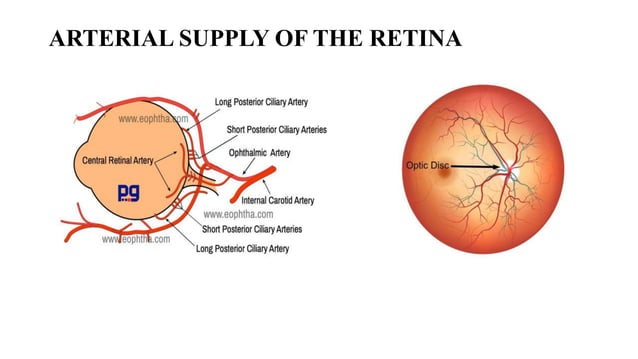RETINAL ARTERY OCCLUSIONS CRAO BRAO CLRAO | PPTX | Eye and Vision ...