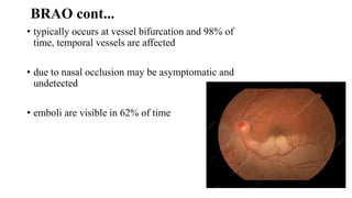 RETINAL ARTERY OCCLUSIONS CRAO BRAO CLRAO | PPTX