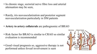 RETINAL ARTERY OCCLUSIONS CRAO BRAO CLRAO | PPTX