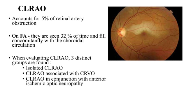 RETINAL ARTERY OCCLUSIONS CRAO BRAO CLRAO | PPTX | Eye and Vision ...
