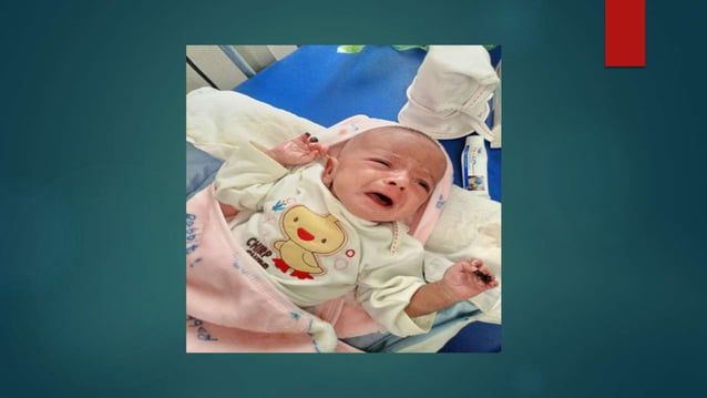 Protein C deficiency in Neonate - rare presentation | PPTX | Pregnancy ...