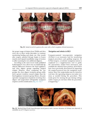 An-integrated-3D-driven-protocol-for-surgery-first.pdf