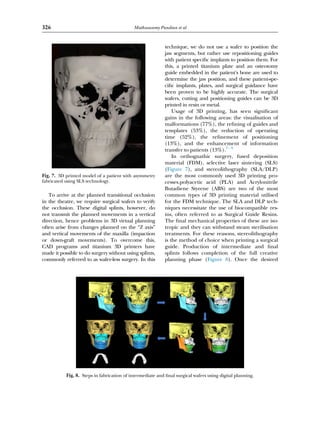 An-integrated-3D-driven-protocol-for-surgery-first.pdf