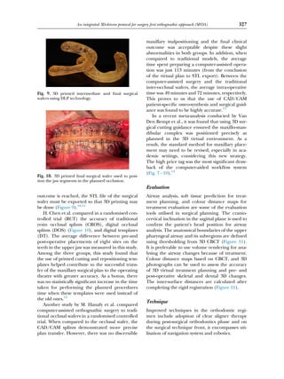An-integrated-3D-driven-protocol-for-surgery-first.pdf
